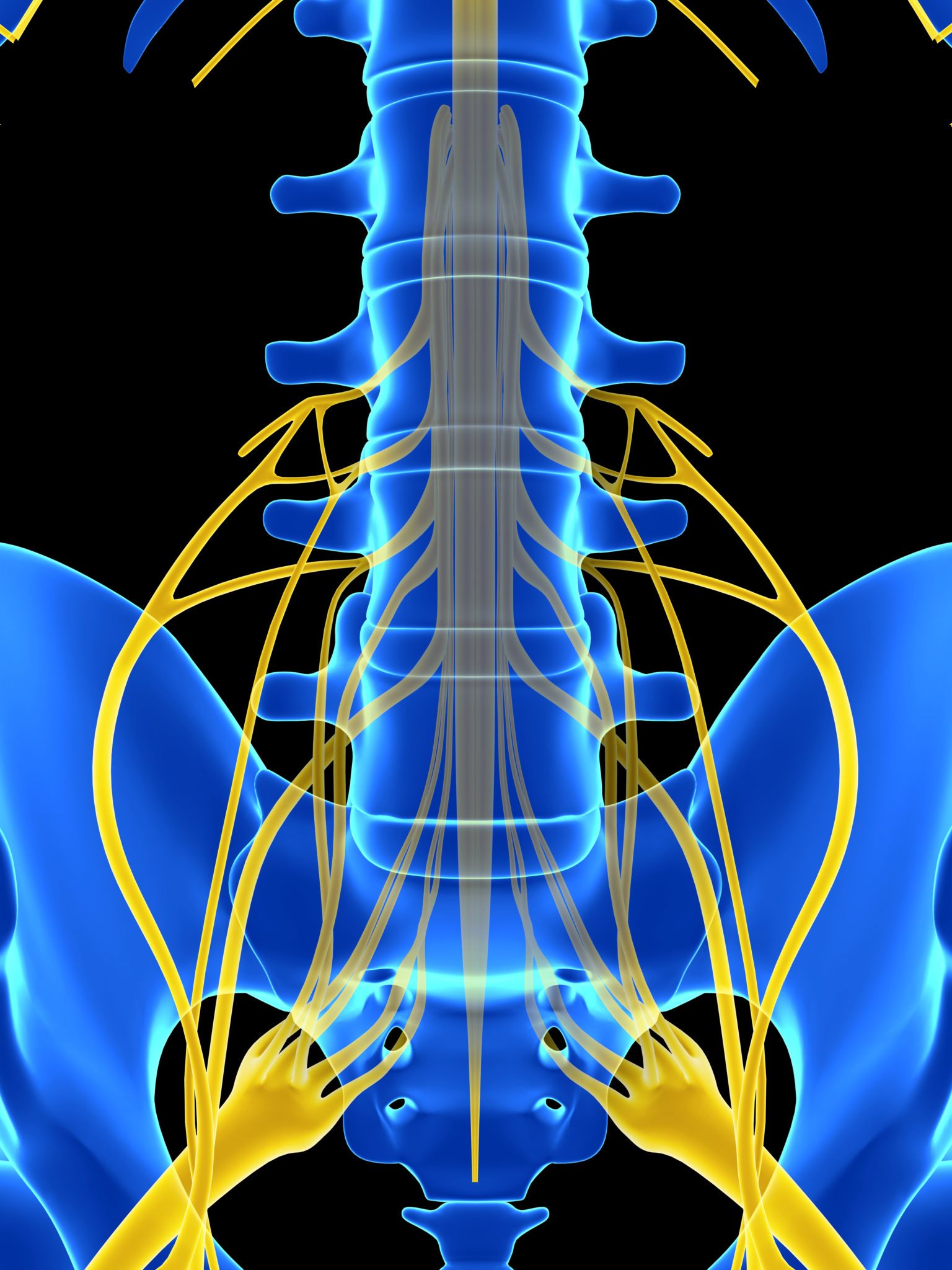 Lumbar referred leg pain | Physica